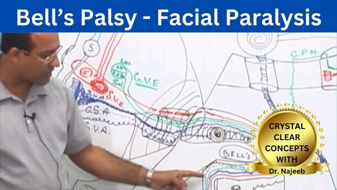 Bell’s Palsy | Facial Paralysis | Neuroscience - YouTube