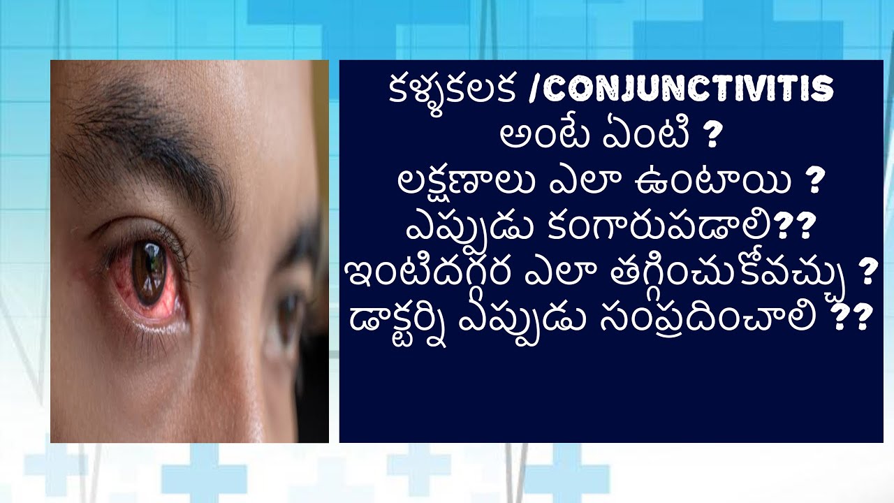 Family doctor1822| Conjunctivitis|causes|symptoms|self care|treatment ...