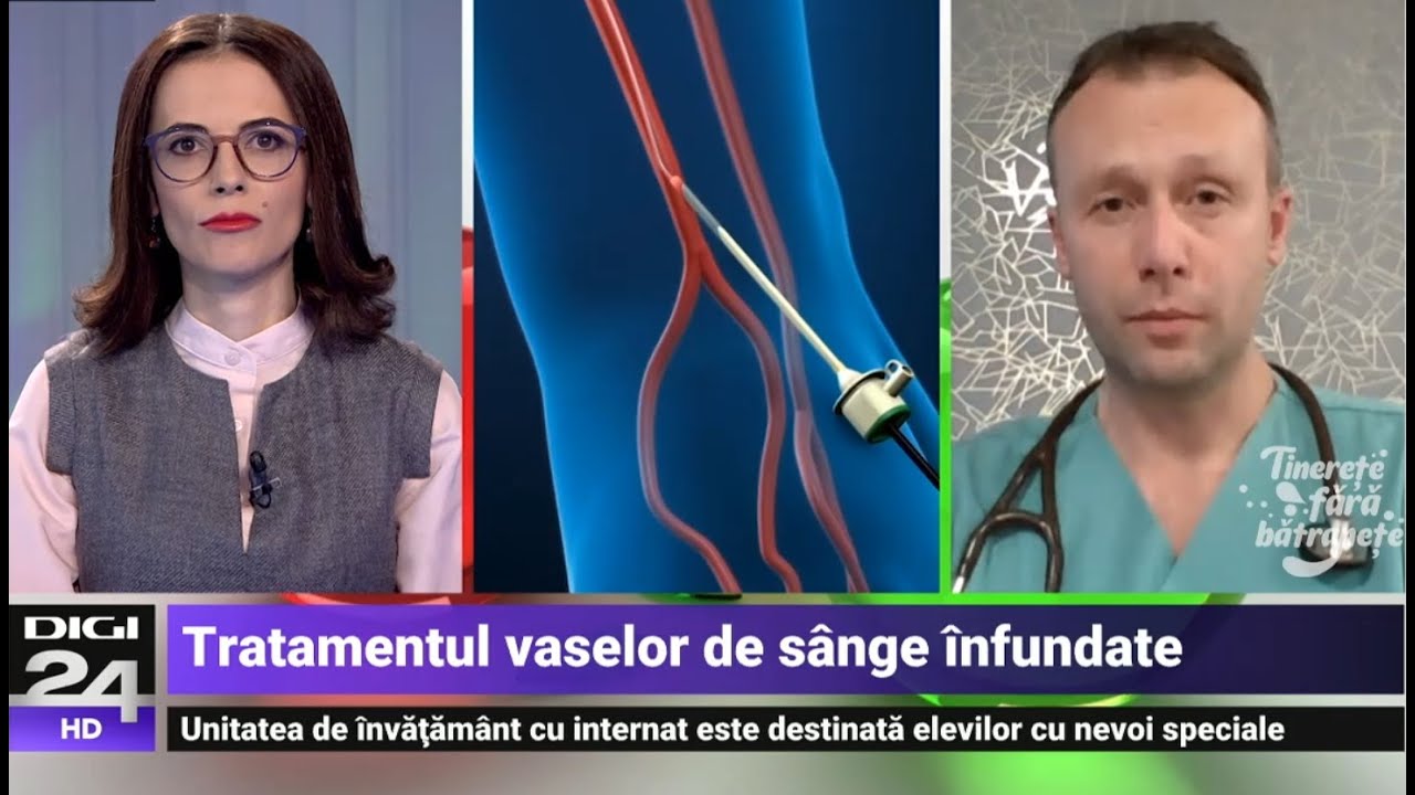 Arterocleroza - Tratamentul vaselor de sânge înfundate - YouTube