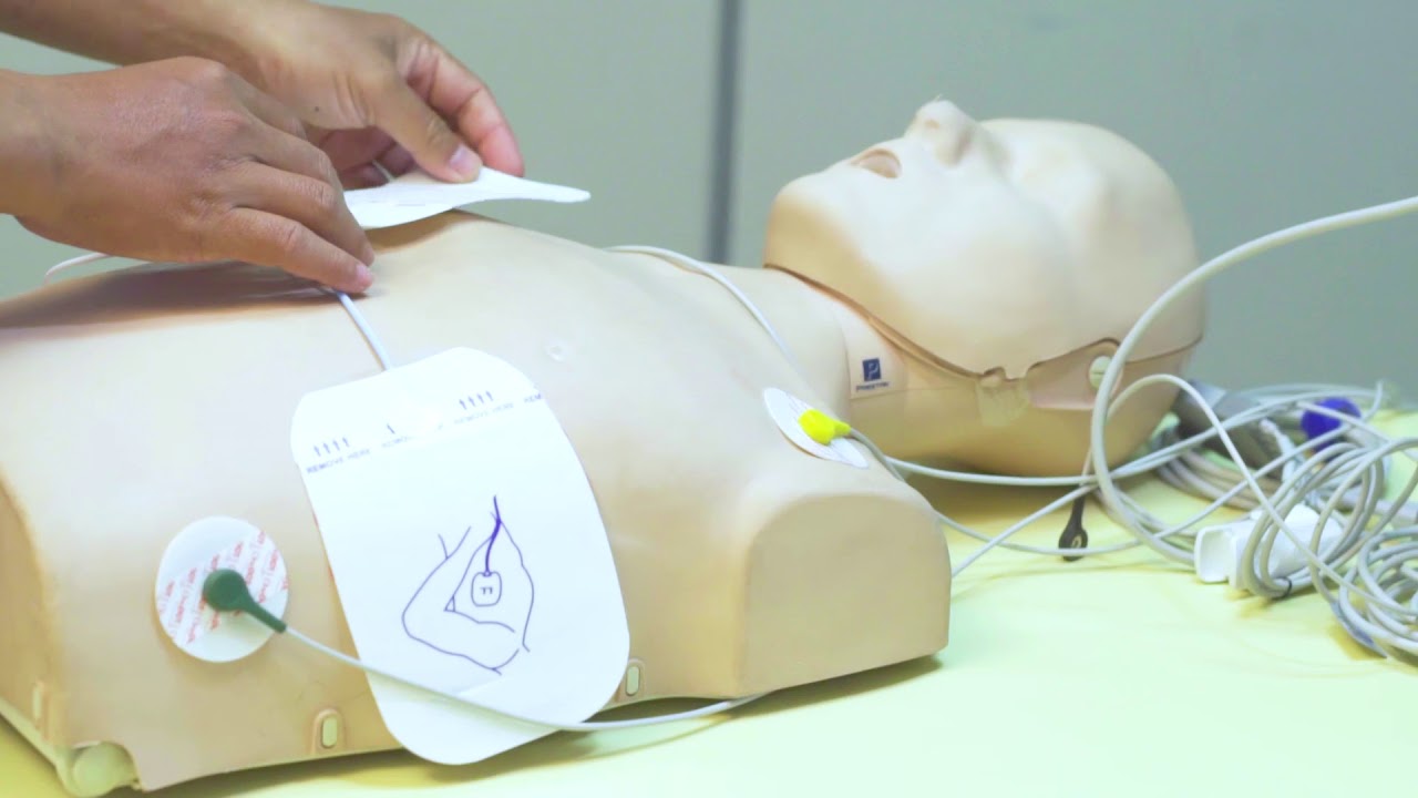 operasional dc shock mindray - YouTube