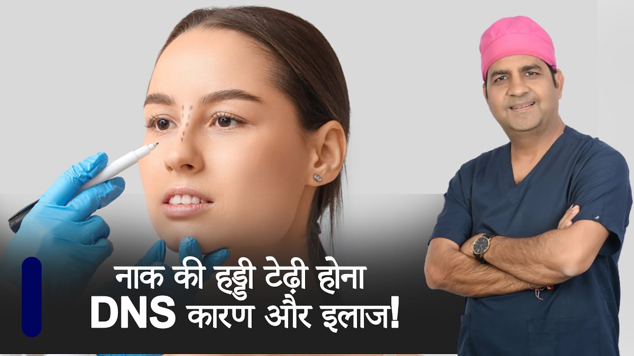 DNS कारण और इलाज | DNS का treatment | Deviated Nasal Septum ...