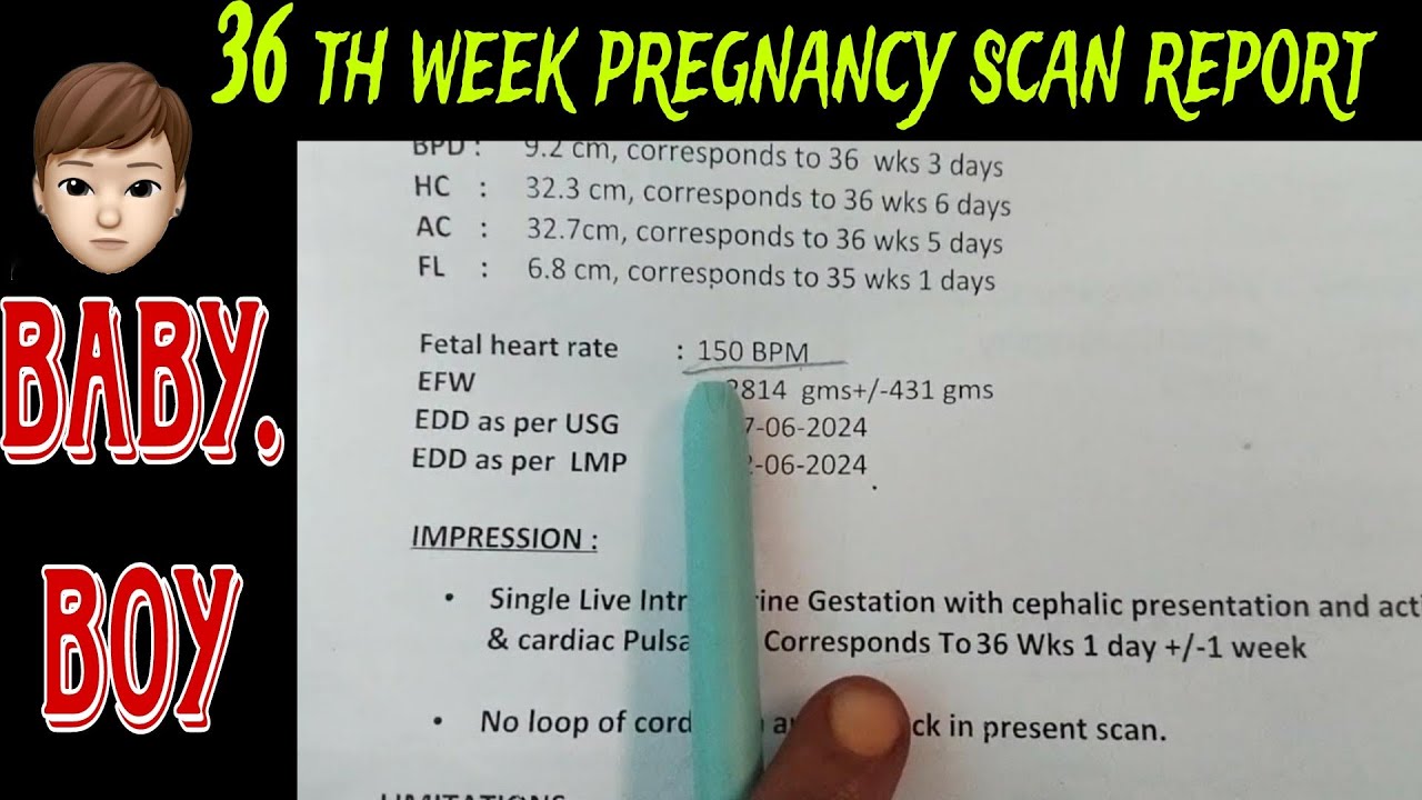 baby boy//36 weeks pregnancy scan report/f.h.r/placenta position # ...