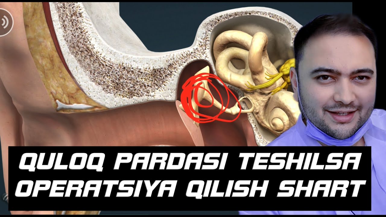 QULOQ PARDASI TESHILSA OPERATSIYA QILISH SHARTMI? - YouTube