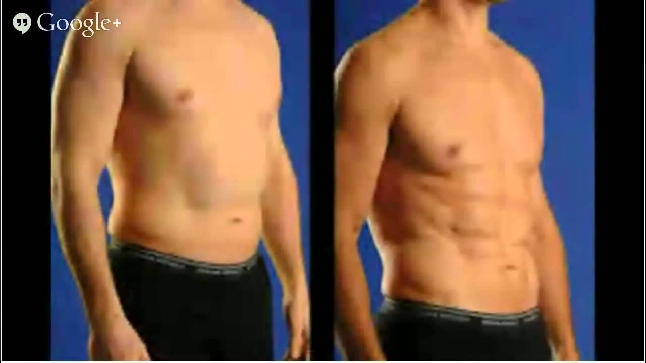 High Definition Lipo Liposuction, Lipo, HD Lipo, - YouTube