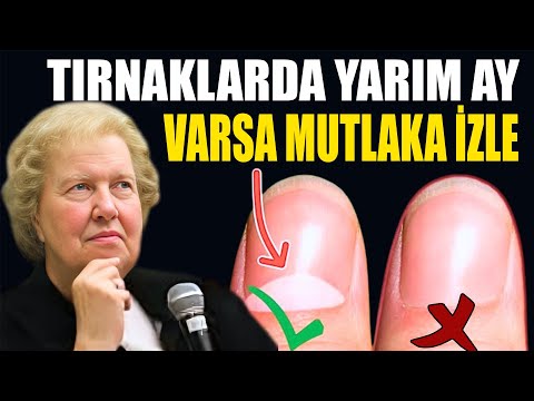 Baş Parmağında Yarım Ay Şeklinde İşaret (MUHTEŞEM ) Bir Spirituel Mesaj İçerir | Dolores Cannon