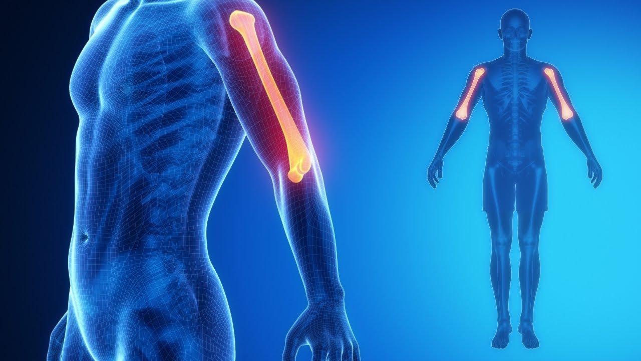 How To Fix a Triceps Tendon Rupture - YouTube