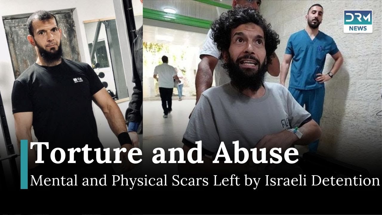 Palestinians Released from Israeli Jails Bear Scars of Torture and ...