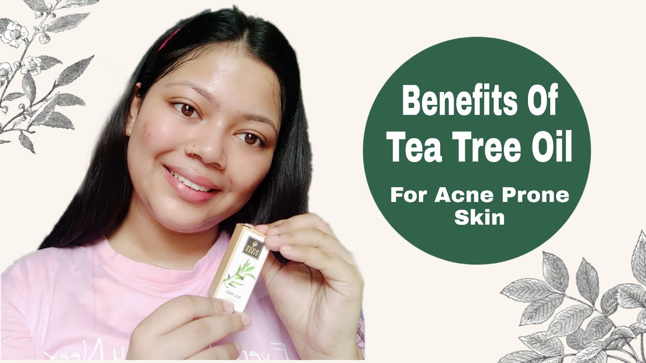 How To Use Tea Tree Oil For Pimples,Acne ,Acne Marks|Benefits Of Tea ...