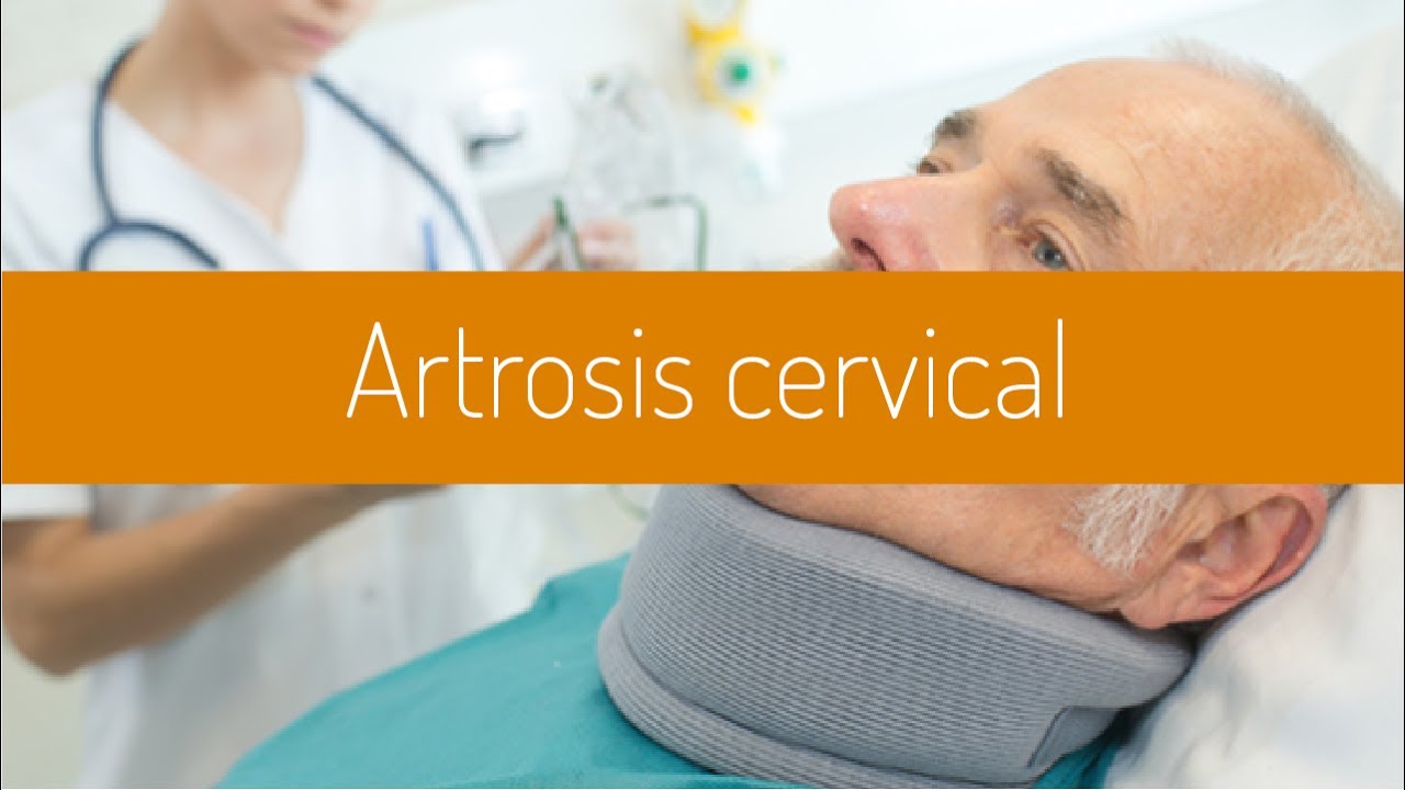 Artrosis cervical - YouTube
