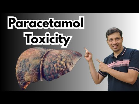 Paracetamol Toxicity Explained | Dose, Stages & Treatment | Must-Know for MBBS Students