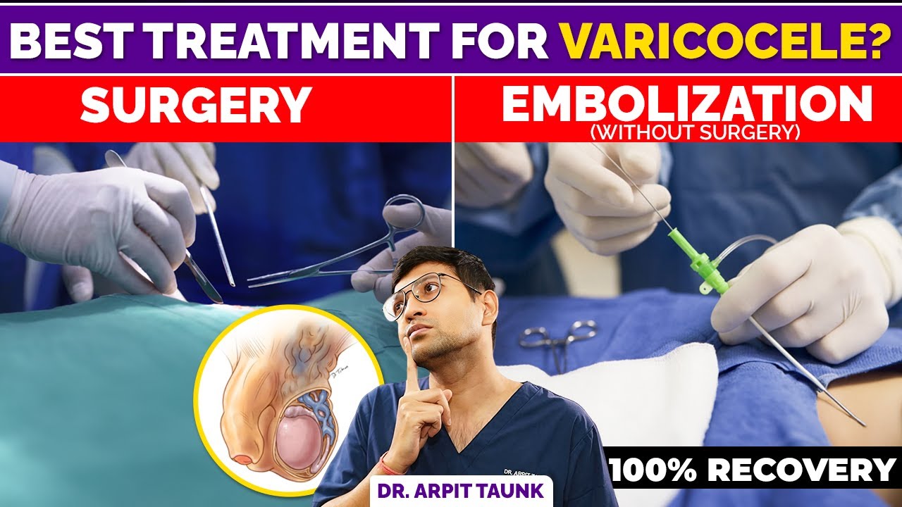 Best Treatment for Varicocele in Hindi | Varicocele Surgery Vs ...