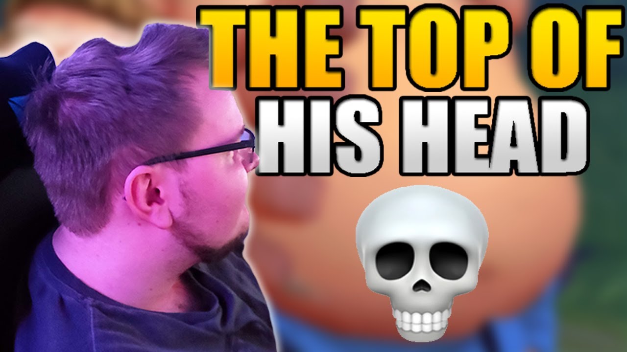 LOOK AT THE TOP OF HIS HEAD💀 - YouTube
