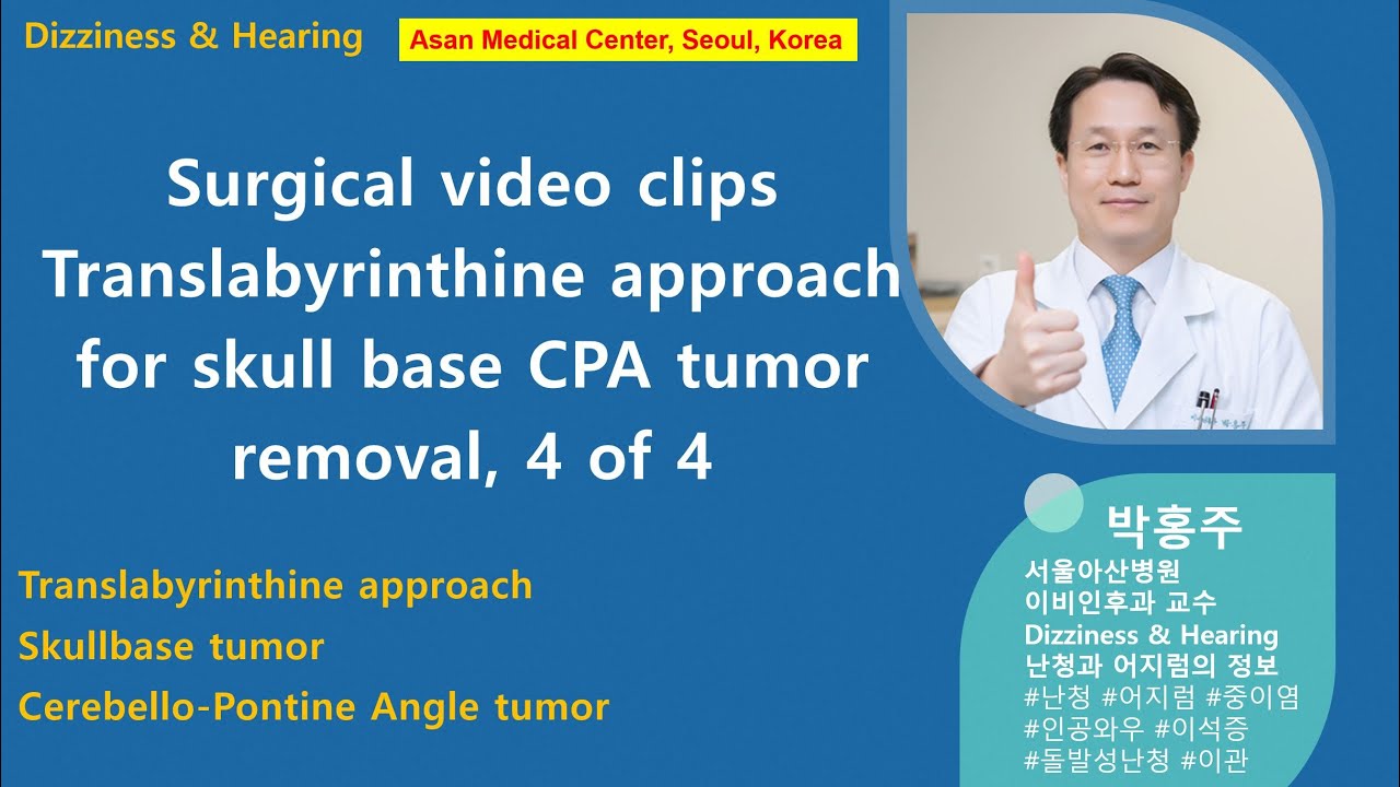 Surgical video clips_Translabyrinthine approach for skull base CPA ...