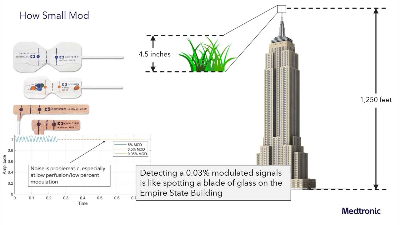 Nellcor™ Pulse Oximetry Overview Pt.6: Engineering Sensor Design ...