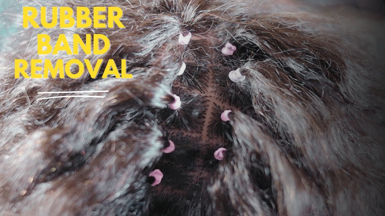 ASMR Removing Rubber Bands on Natural Hair + Scalp Check For Deep Sleep ...