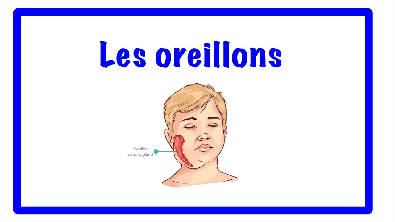 🔵Les oreillons - YouTube