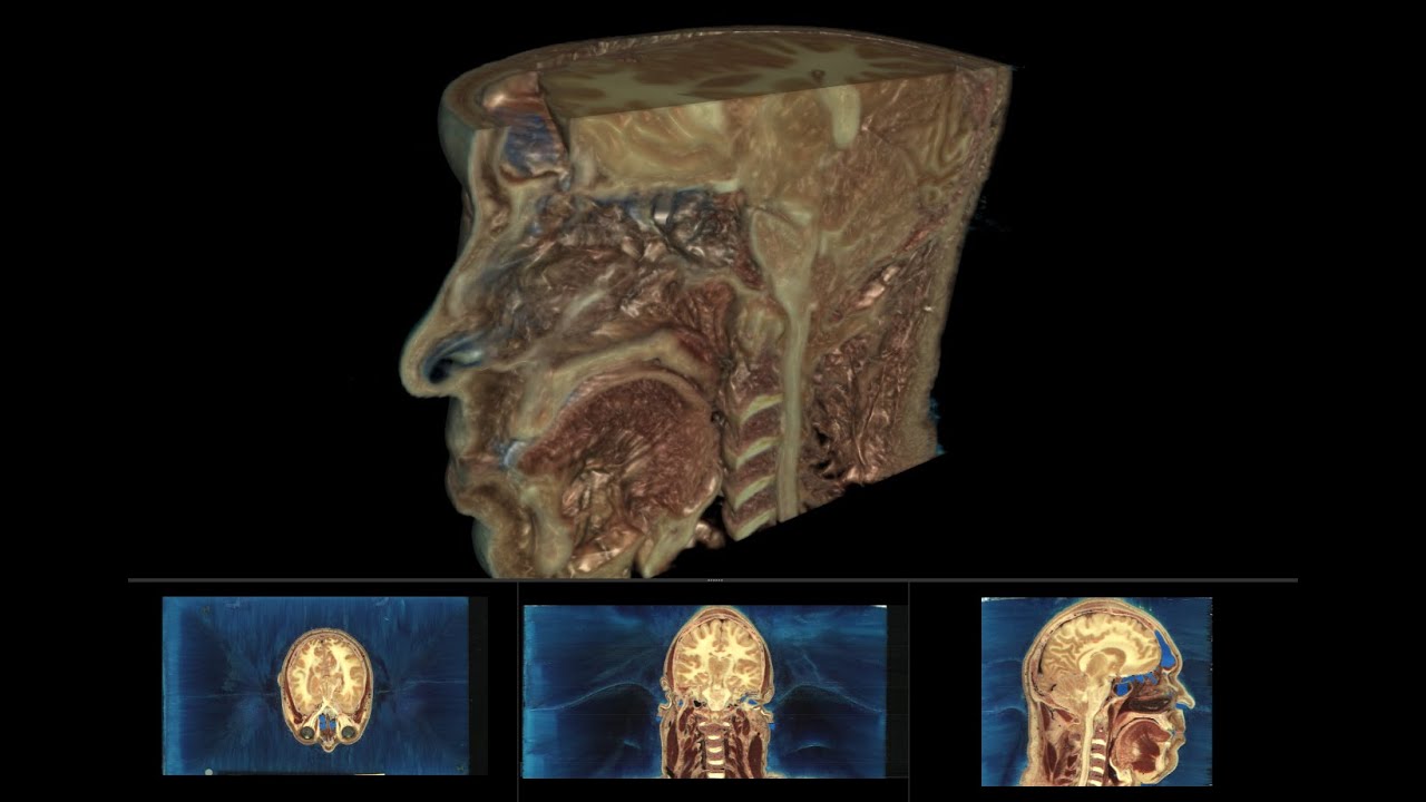 Color (RGB) volume rendering - YouTube