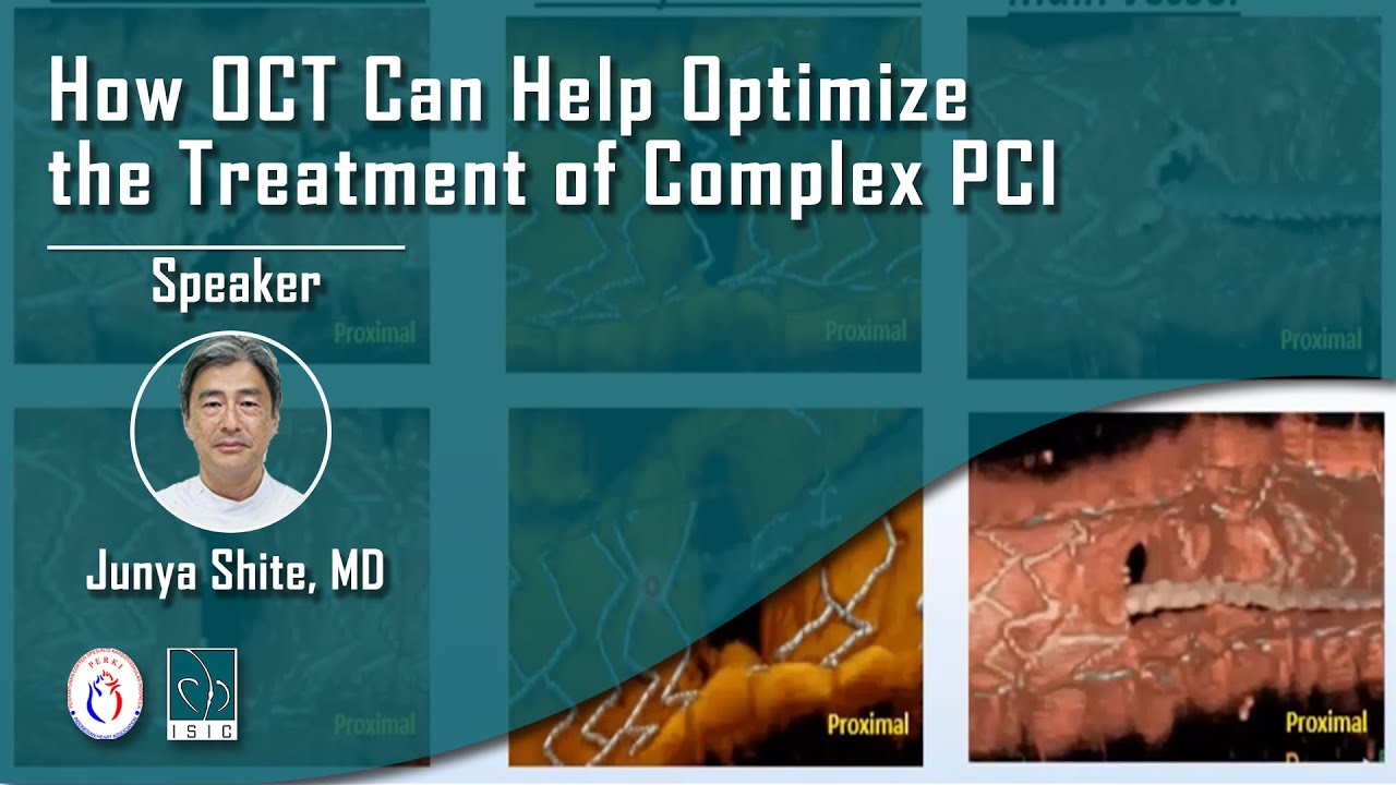 How OCT Can Help Optimize the Treatment of Complex PCI - YouTube