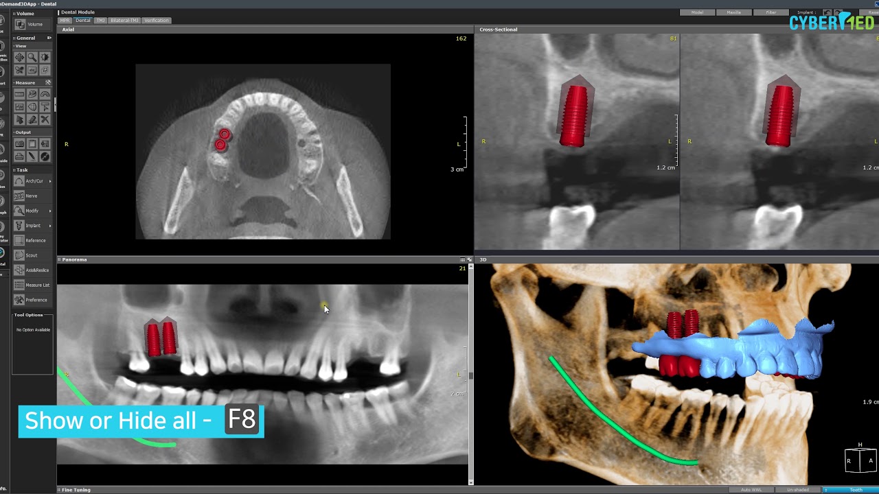 OnDemand3D Tool TIP - shortcut keys - YouTube