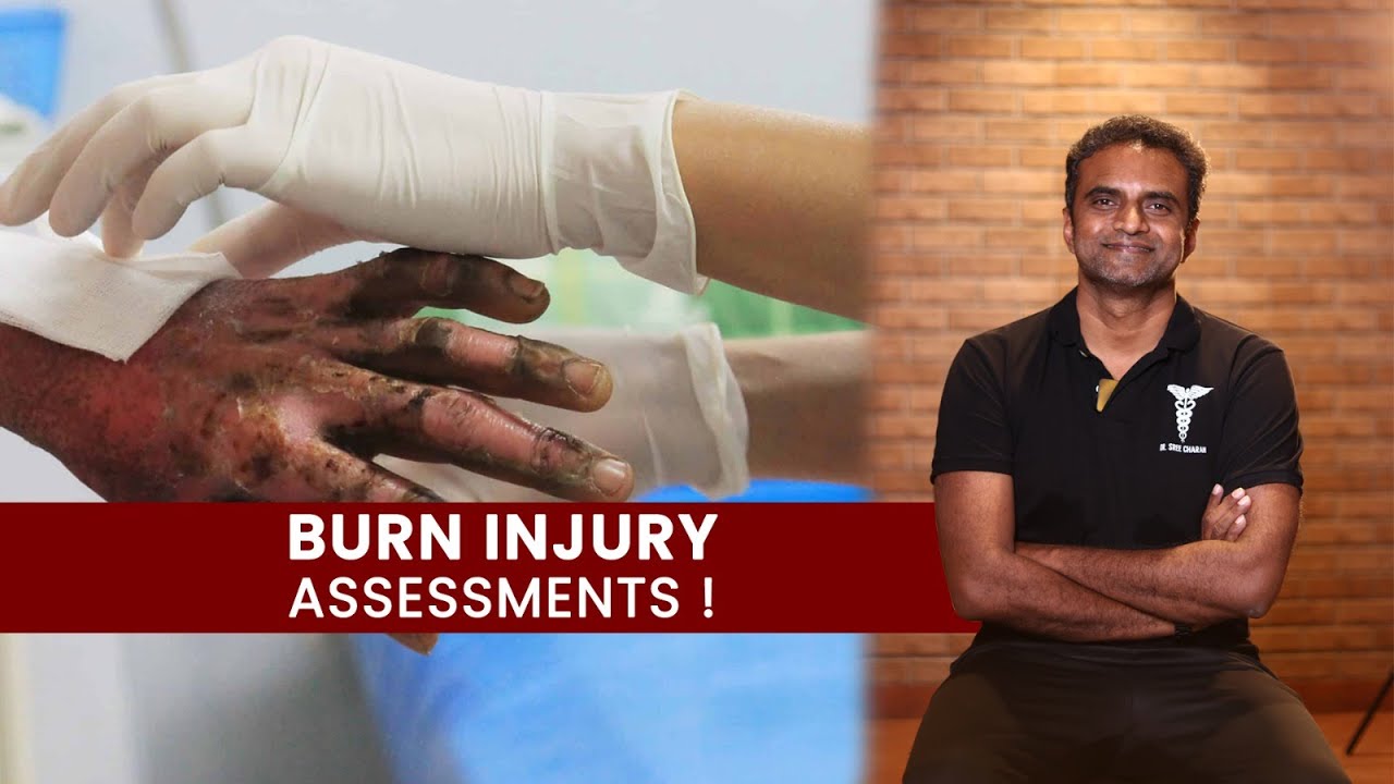 Burn Injury Assessment | Dr. Sree Charan - YouTube