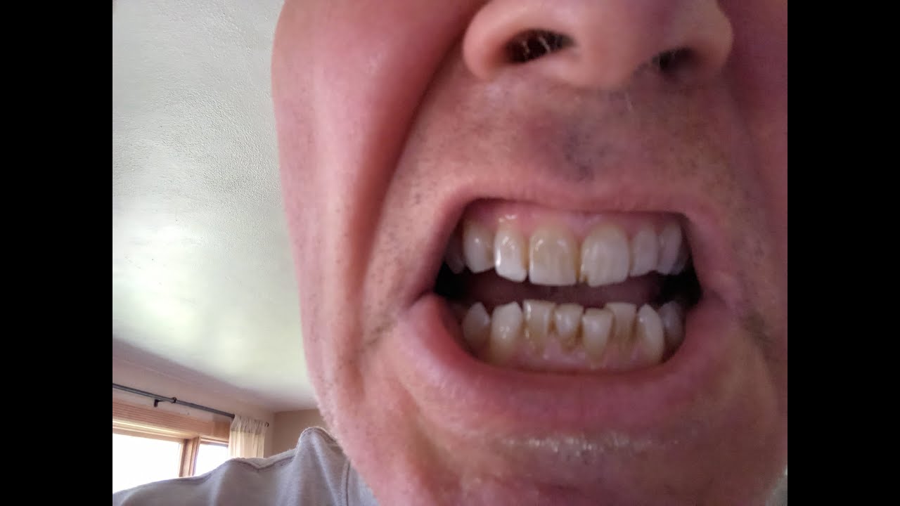 MRGRRR 5-10-23 JACK SPARROW TEETH - YouTube