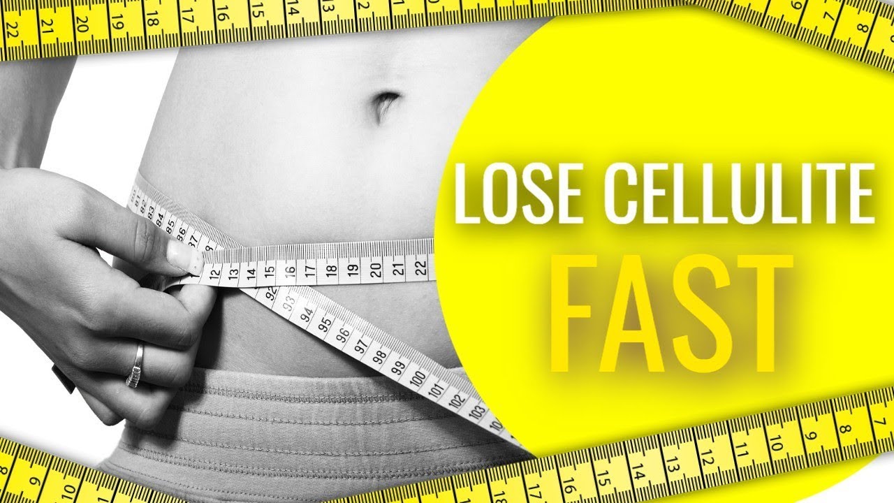 Does Cupping Really Get Rid Of Cellulite | Best Way to Remove Cellulite ...