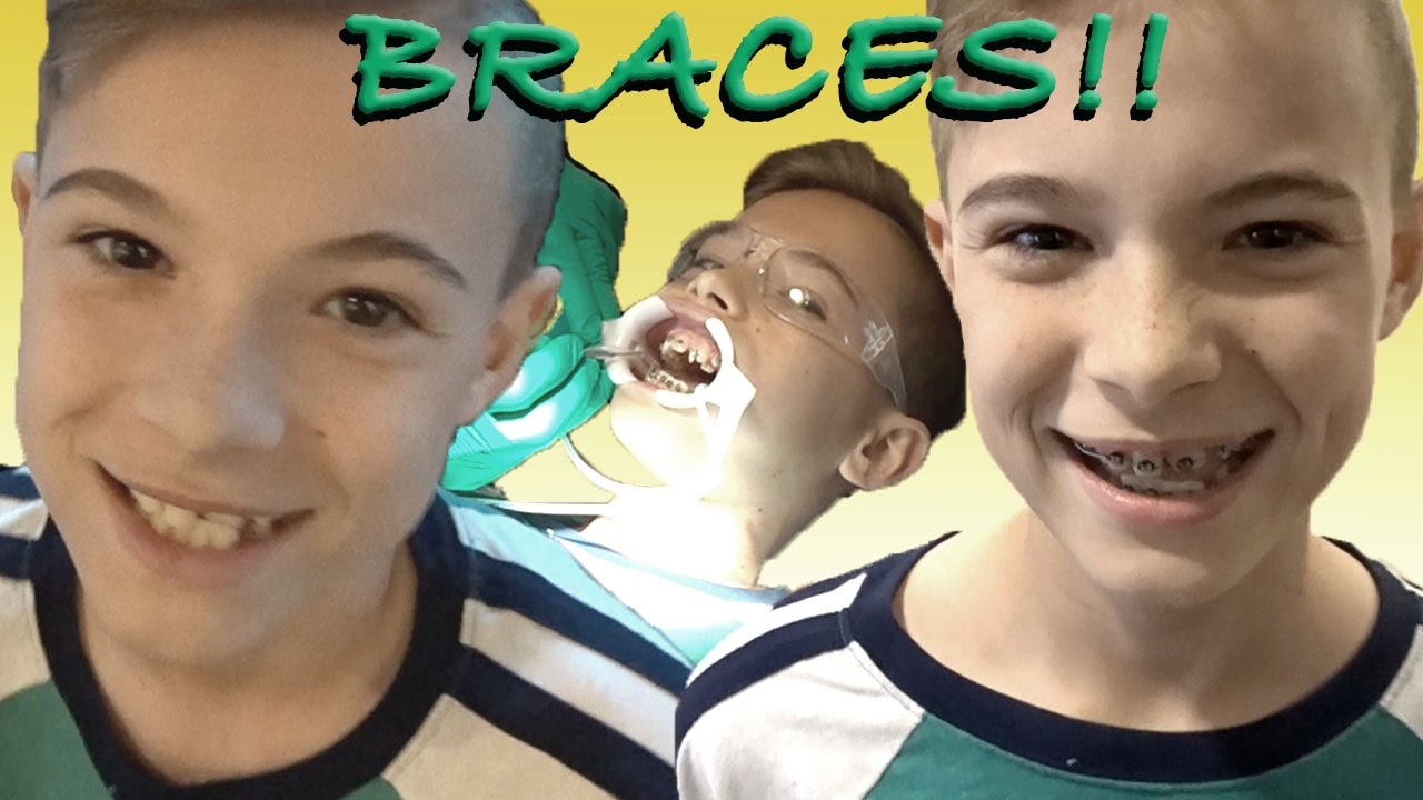 RYAN GETS BRACES! RYAN'S CREW IS THERE TO SUPPORT HIM - YouTube
