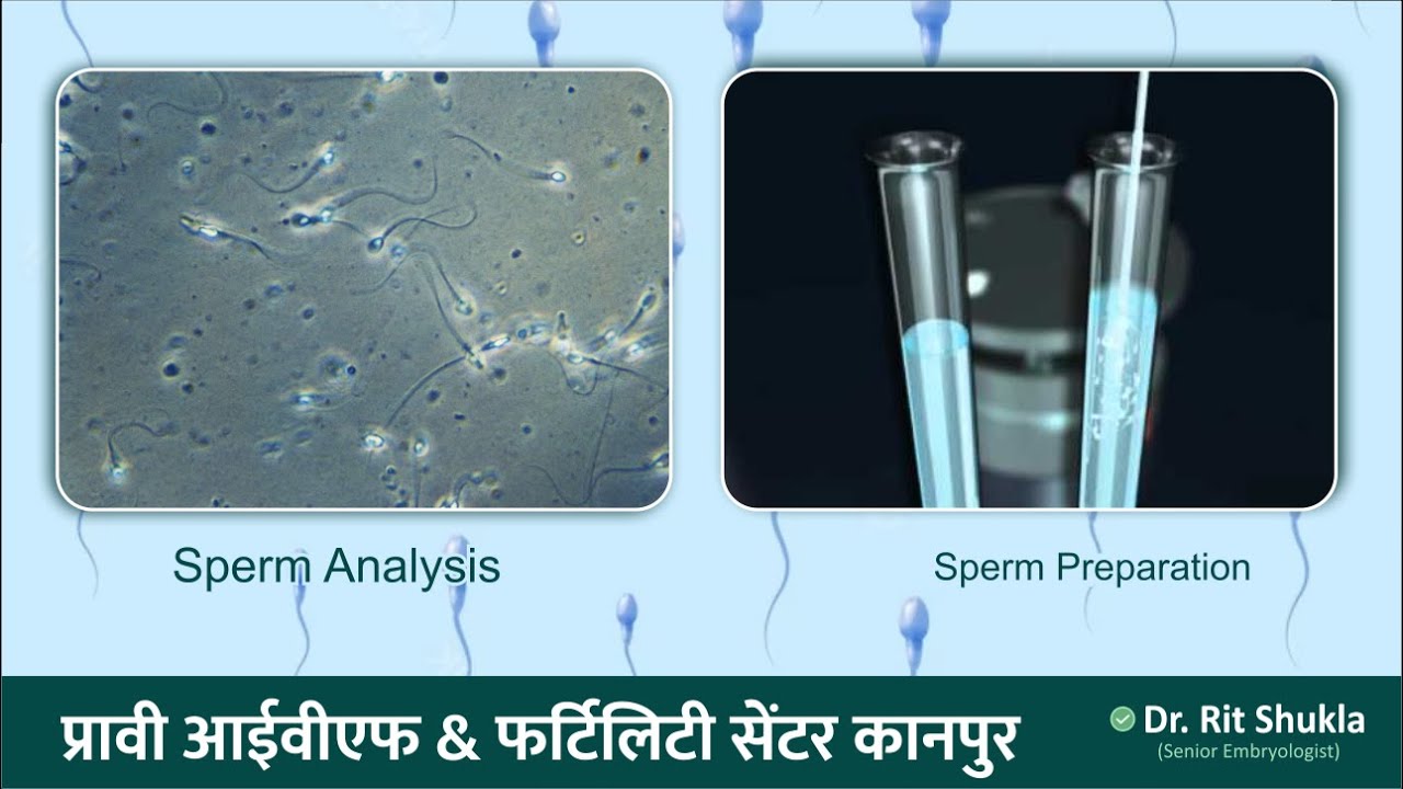 Sperm Analysis और sperm preparation में अंतर | Difference between Sperm ...