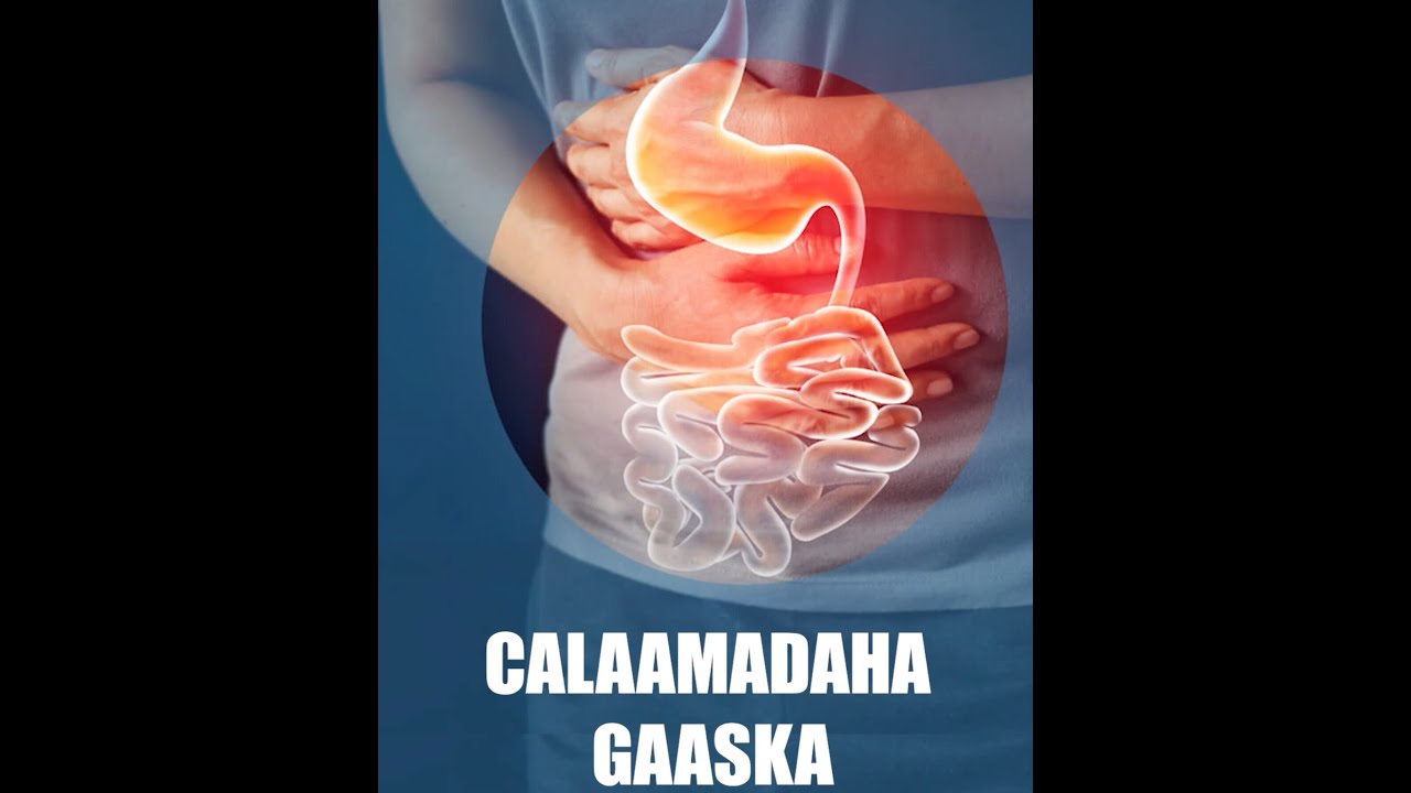 𝟏𝟎-Calaamadood oo aad ku garan karto, 𝐜𝐮𝐝𝐮𝐫𝐤𝐚 𝐠𝐚𝐚𝐬𝐤𝐚. - YouTube