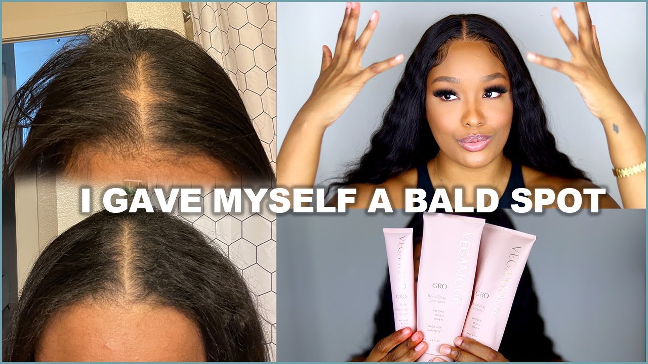 How I Gave Myself a Bald Spot and Grew It Back! | Fabulous Bre - YouTube