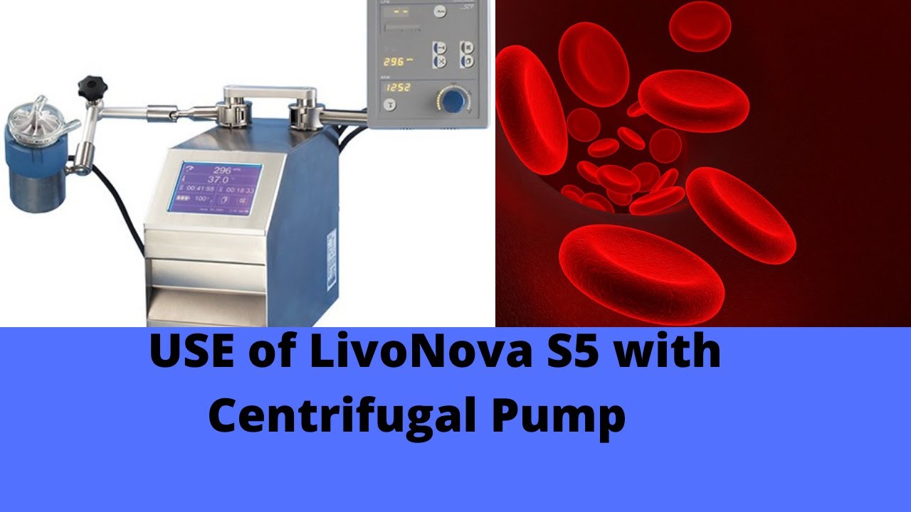 Use of LivoNova S5 Centrifugal pump - YouTube