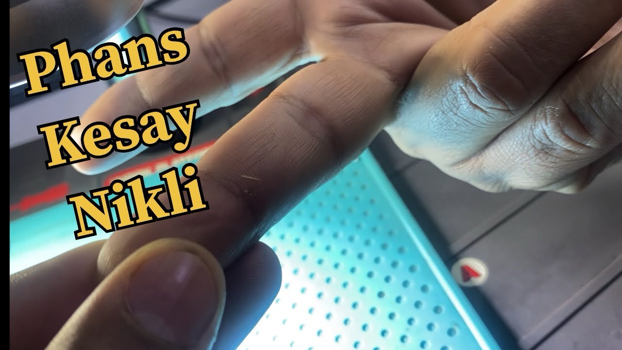 How to Remove a Splinter from Your Finger || DIY tips - YouTube