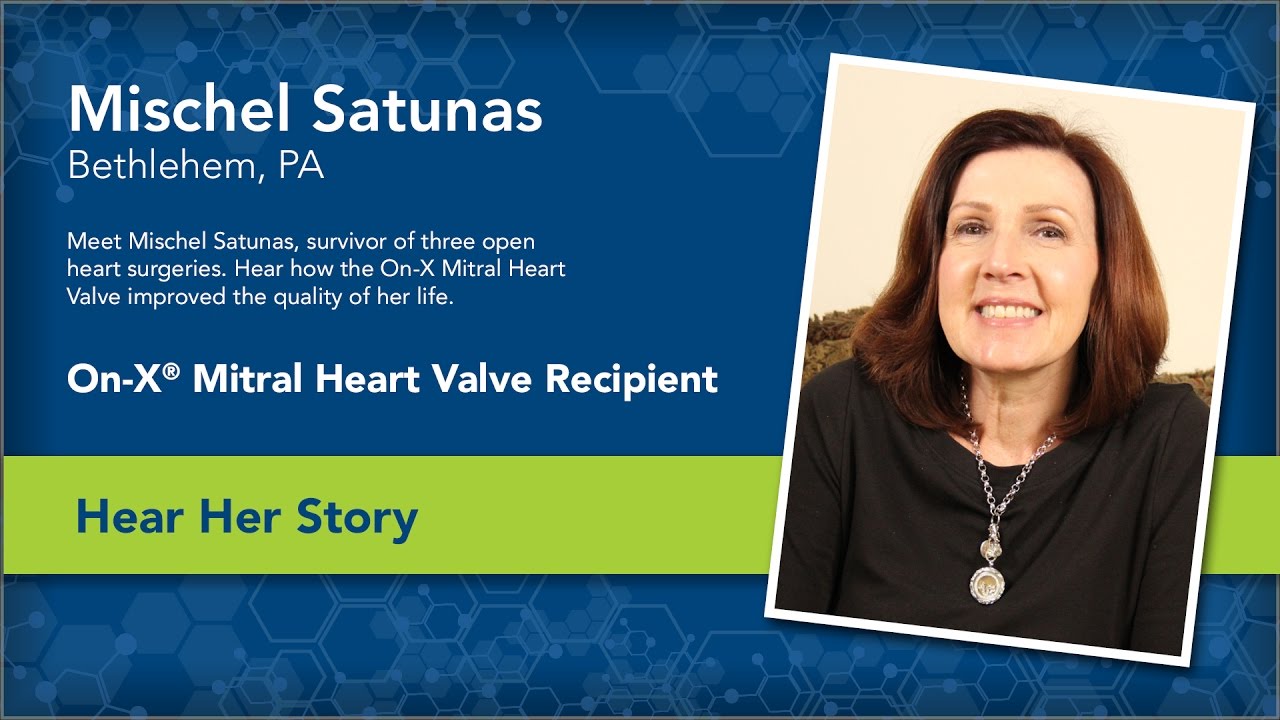 3 Time Open Heart Surgery Patient Mischel Satunas Tells Her Story - YouTube
