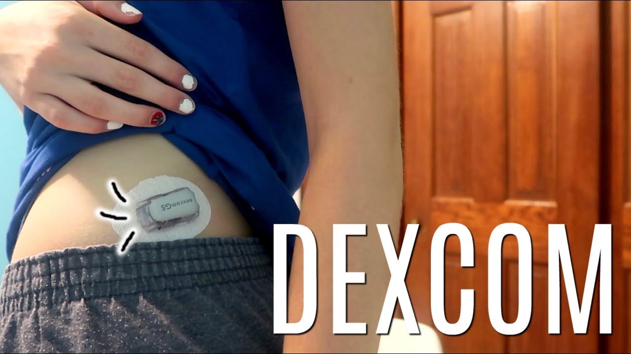 How To Insert A Dexcom G5 | Daily Diabetics | Laina - YouTube