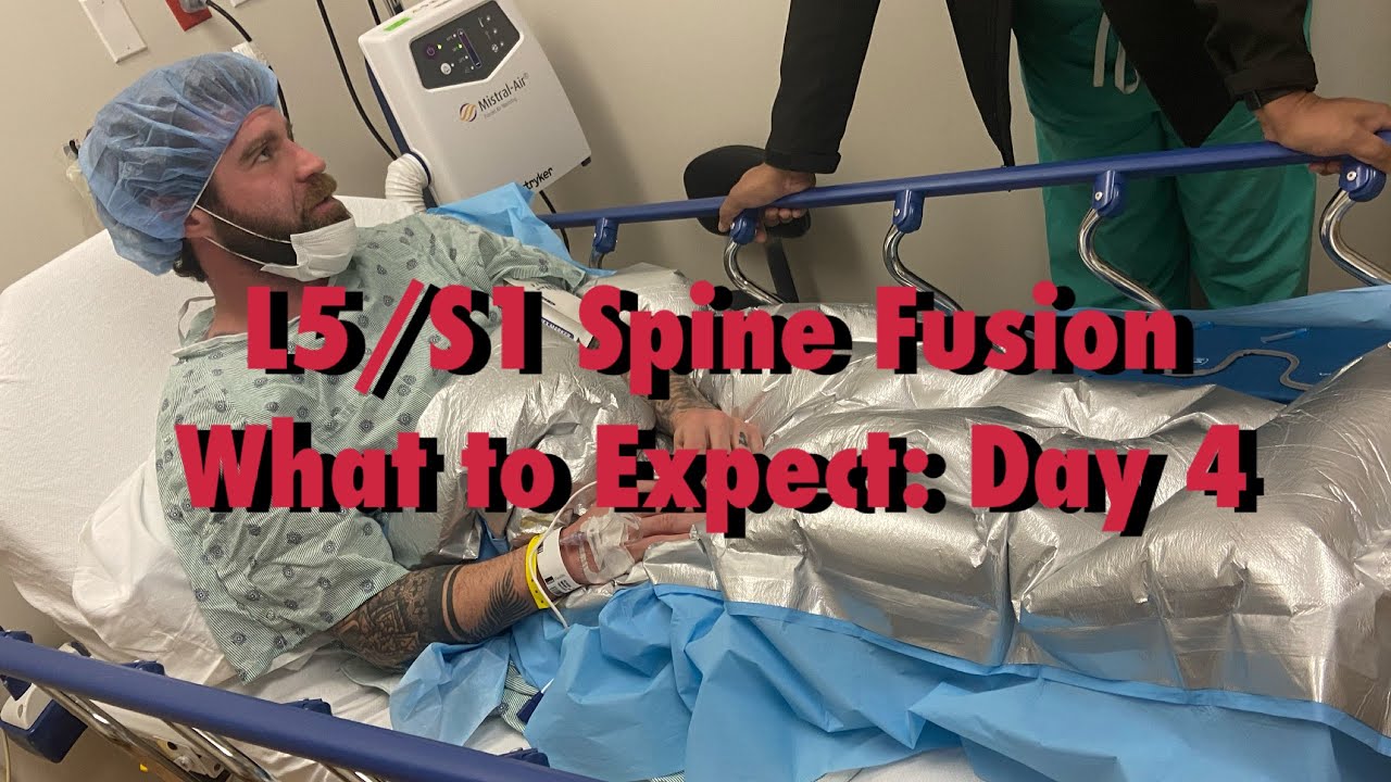 l5-s1-spinal-fusion-what-to-expect-day-4-post-op-youtube
