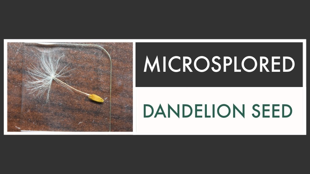 Dandelion Seed under the Microscope [Microsplored] - YouTube