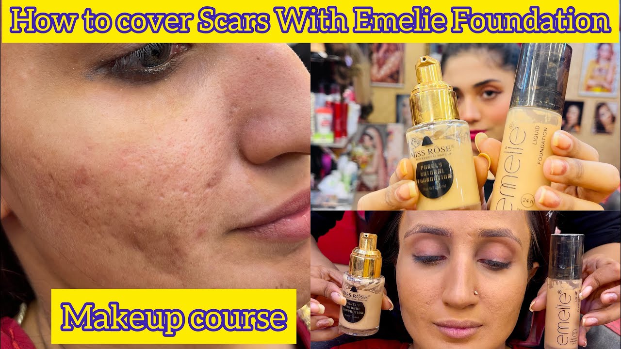 How To Cover Acne Scars With Emelie Foundation? #missrosefoundation ...