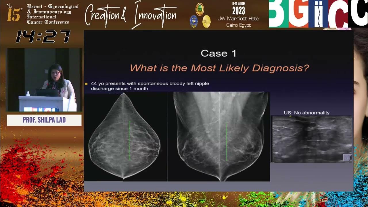 Breast MRI as a Problem Solving Tool byProf Shilpa Lad - YouTube