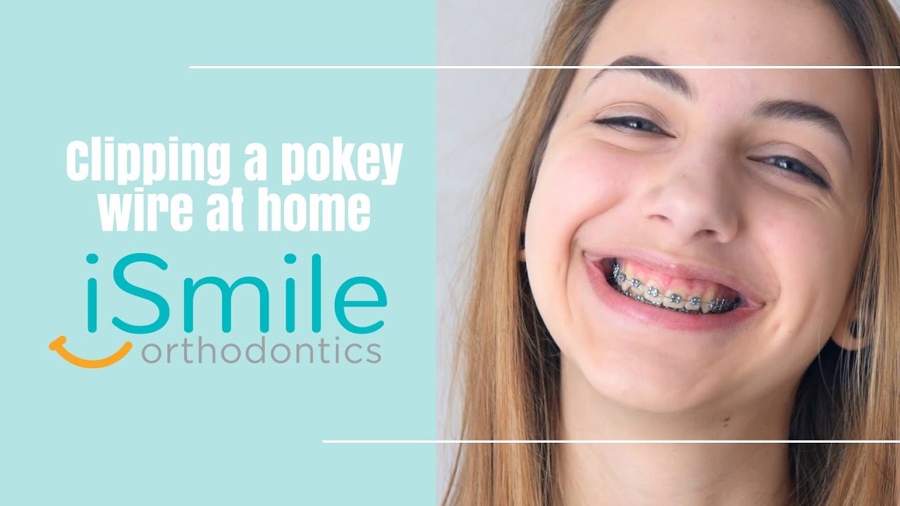 How to Clip a Pokey Wire at Home - YouTube