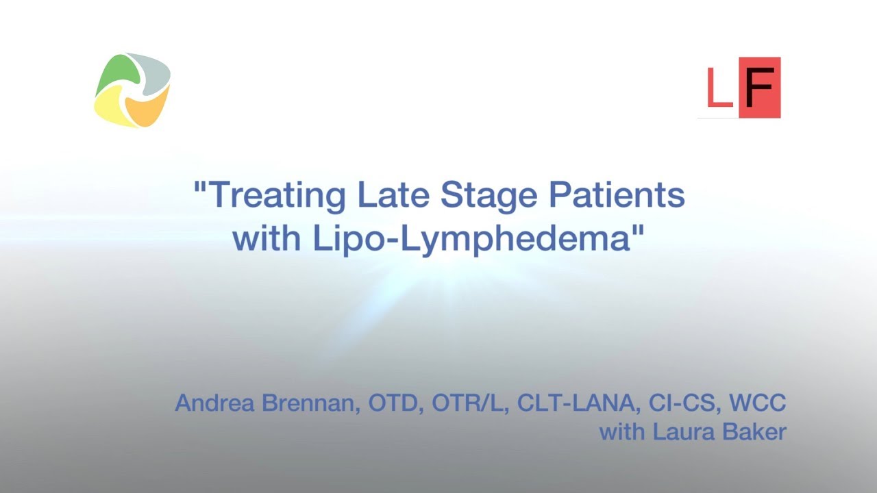 Treating Late Stage Patients with Lipo Lymphedema 3 - YouTube