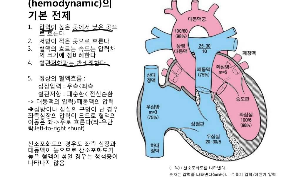 선천성심장질환 Youtube
