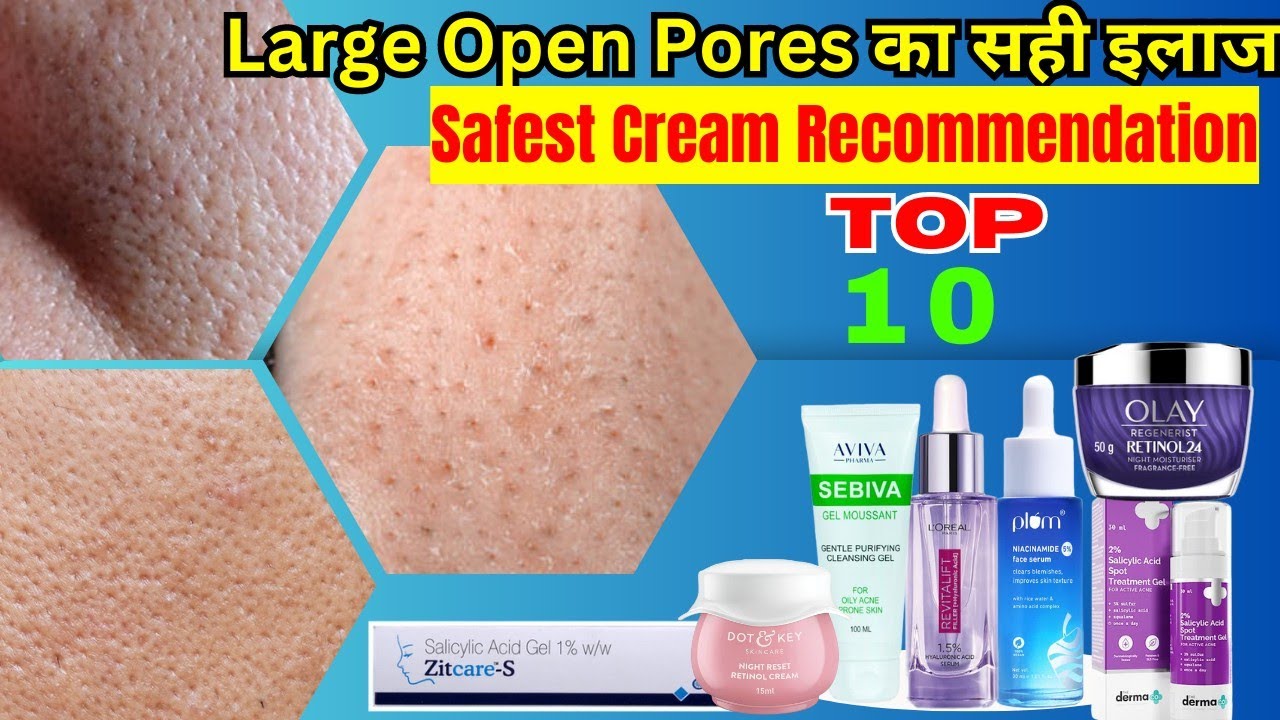 Open pores का इलाज | कैसे ठीरें? safest cream recommendation | Open ...