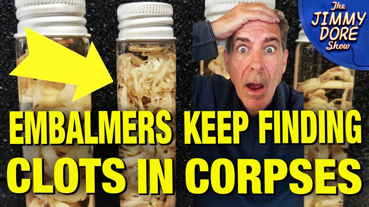 Embalmers Report Persistent Blood Clots in Corpses Since COVID Vaxx ...