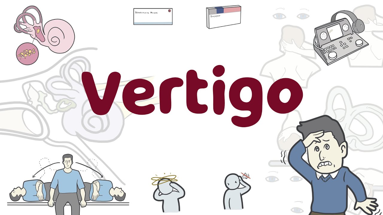 Vertigo, Patofisiologi, Tanda Gejala, Tatalaksana - YouTube