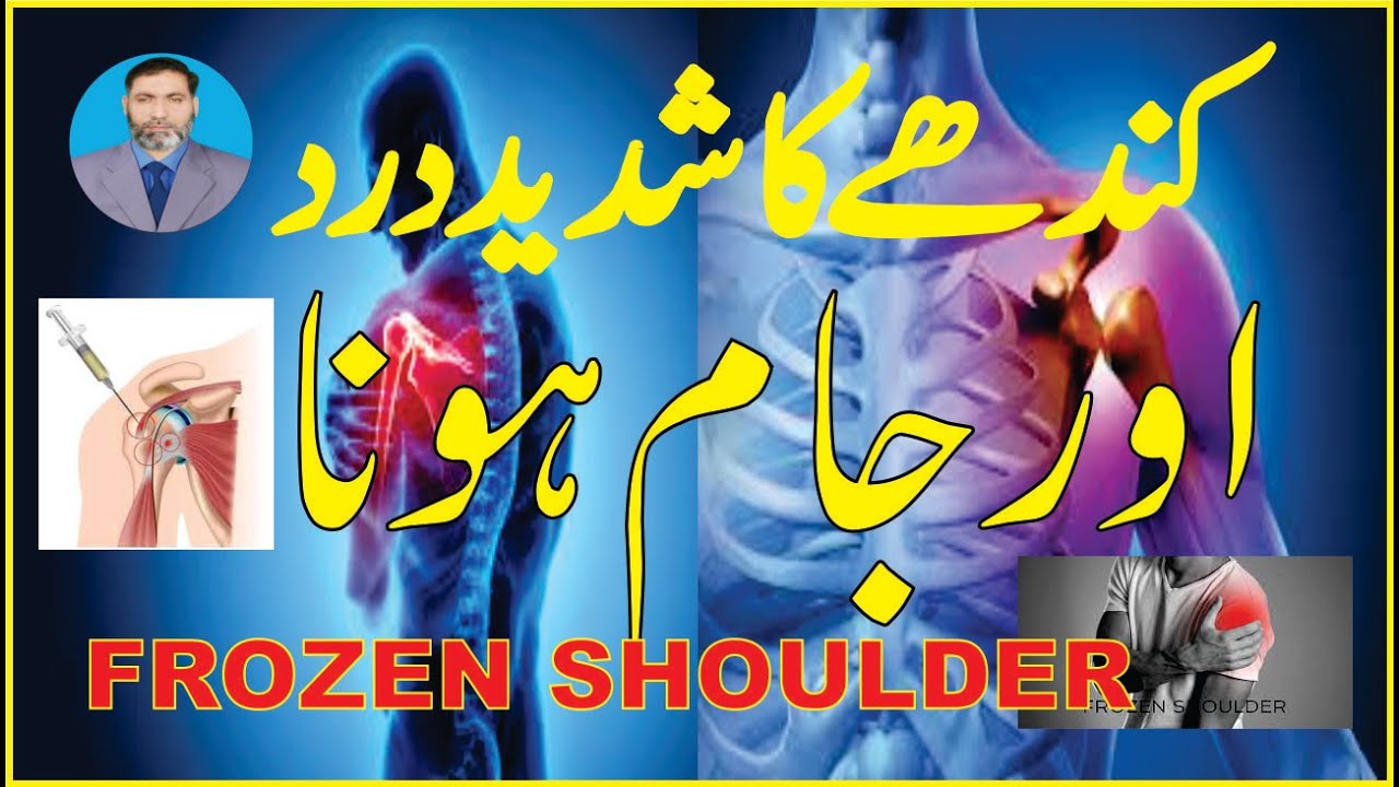 What is Frozen Shoulder syndrome. Diagnosis and treatment. کندھے کا ...
