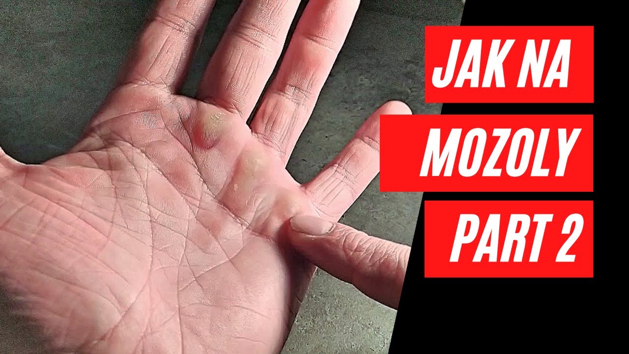 Jak na mozoly Part 2 - YouTube