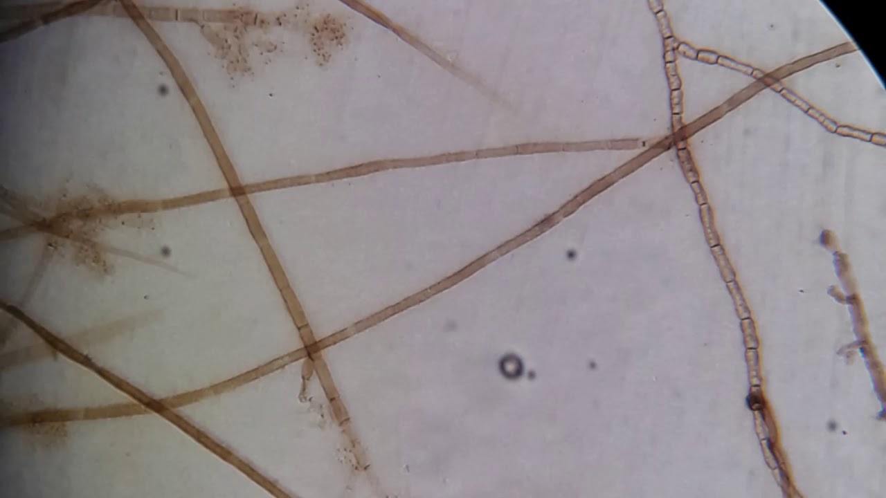 15 Cromomicosis Phialophora verrucosa fialide - YouTube