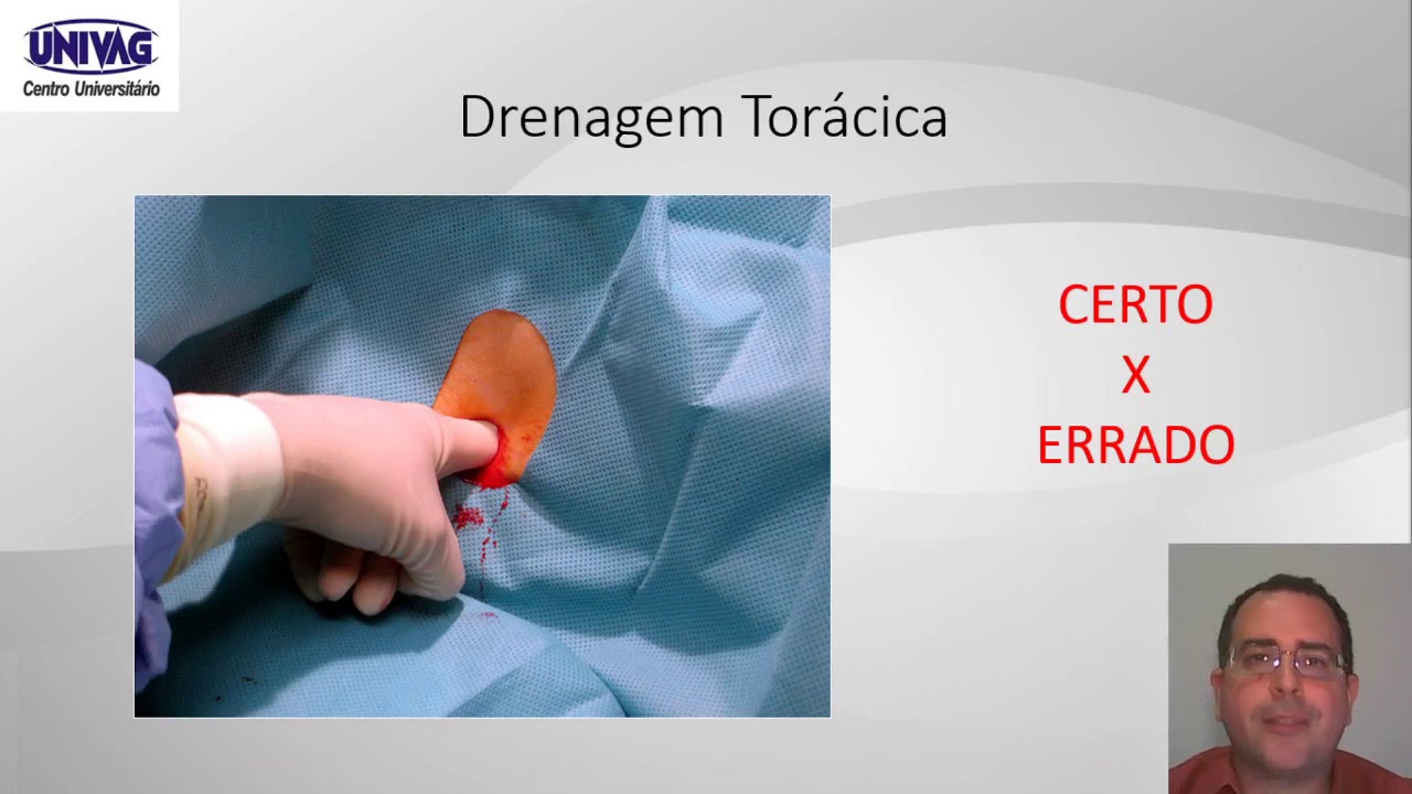 Toracotomia Prof. Vinicius - YouTube