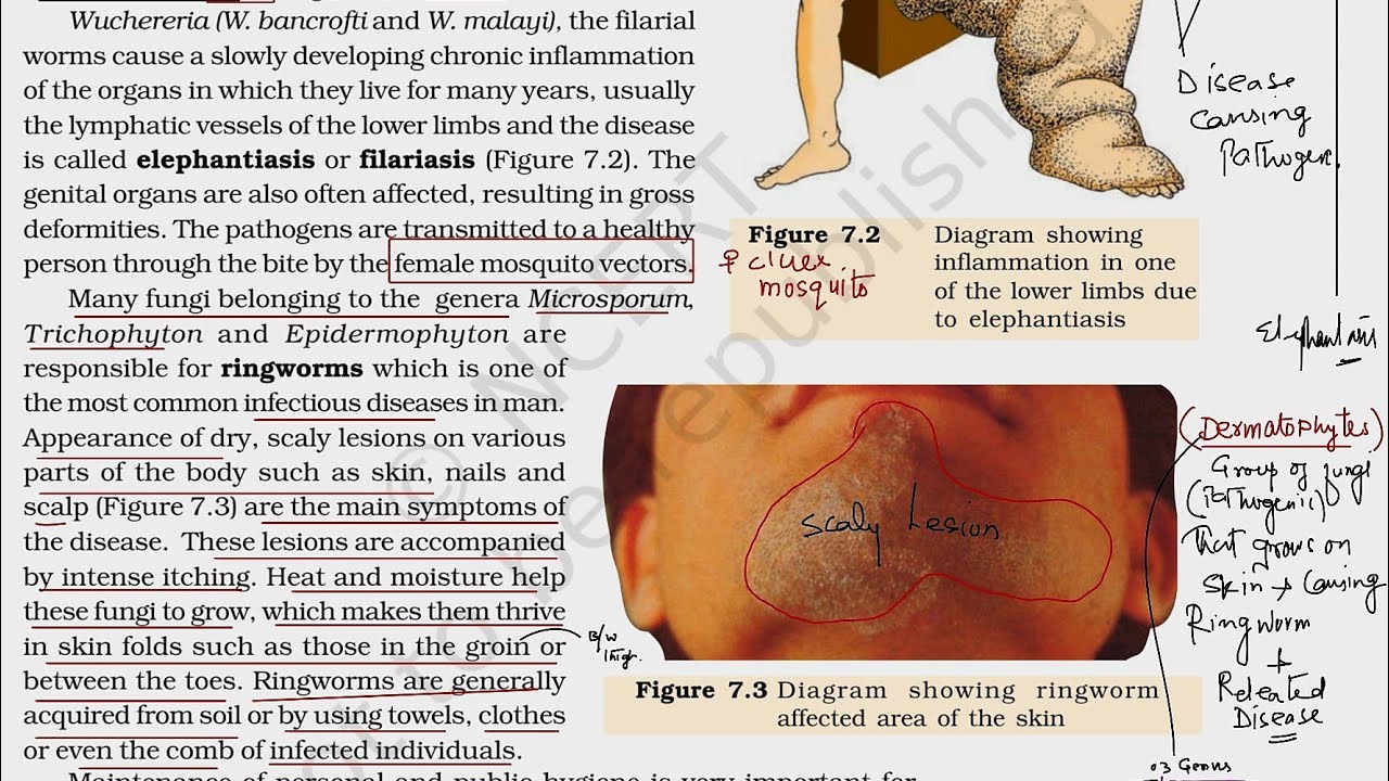 HUMAN HEALTH AND DISEASE ||CH07 || NCERT || PART.4||BIOLOGY||CLASS 12TH ...