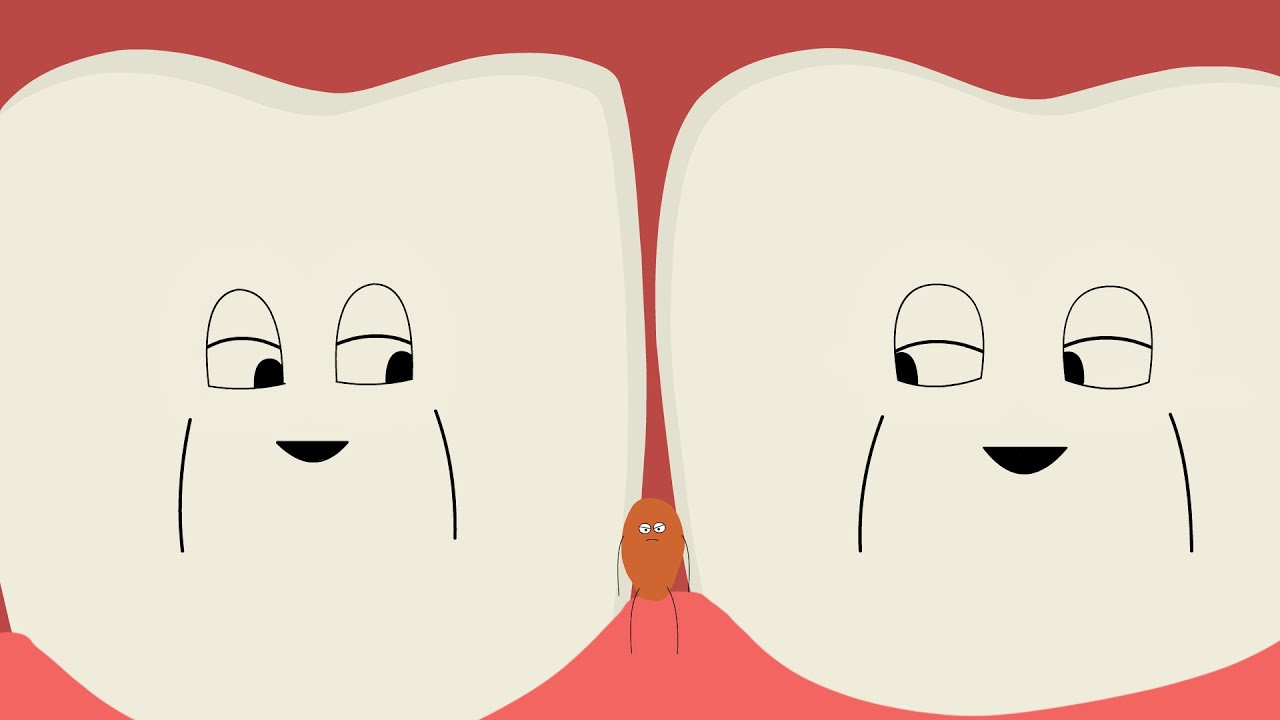 Debris ( Food in Teeth ) | Animated Short | VvePrime - YouTube